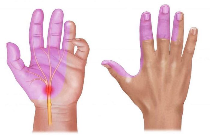 Věnujte pozornost funkčnosti svých rukou. Odchylky mohou být signálem ...