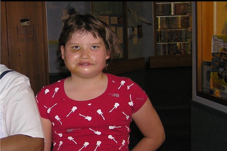 Mladá žena se narodila se vzácným syndromem. Není schopná úsměvu